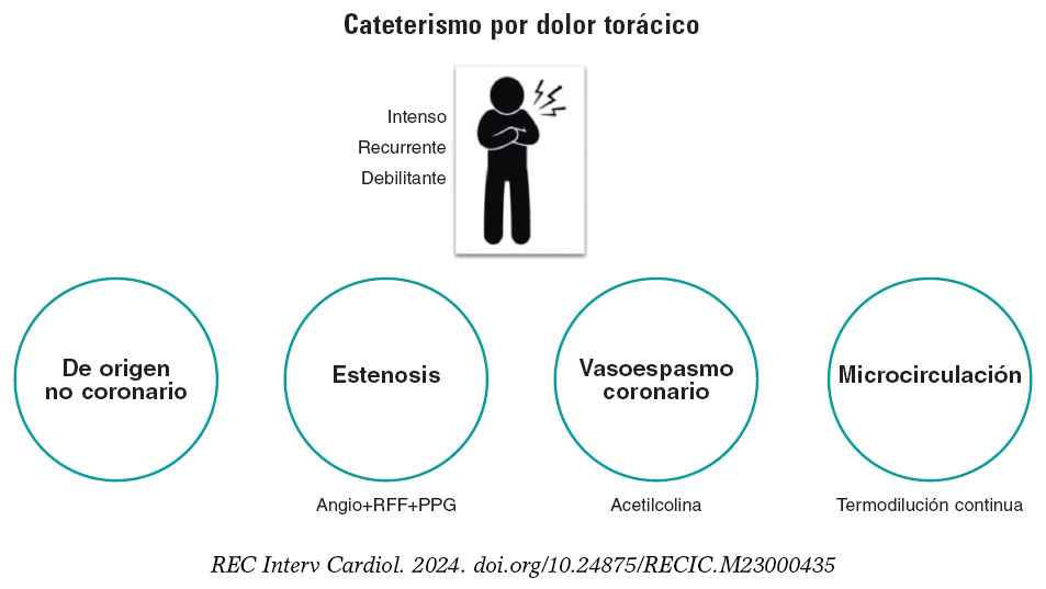 Implementando la vía clínica ANOCA