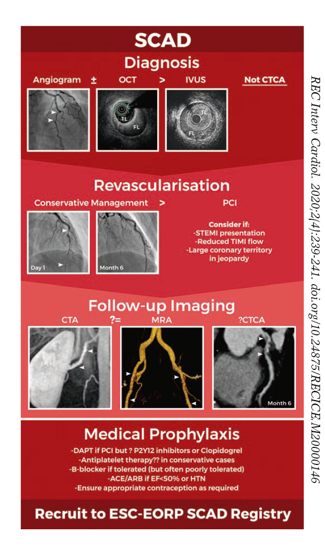 Spontaneous coronary artery dissection: new insights on diagnosis and ...