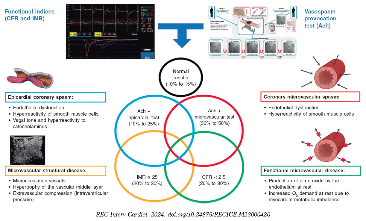 Diagnosis and treatment of patients with ANOCA Consensus document of ...