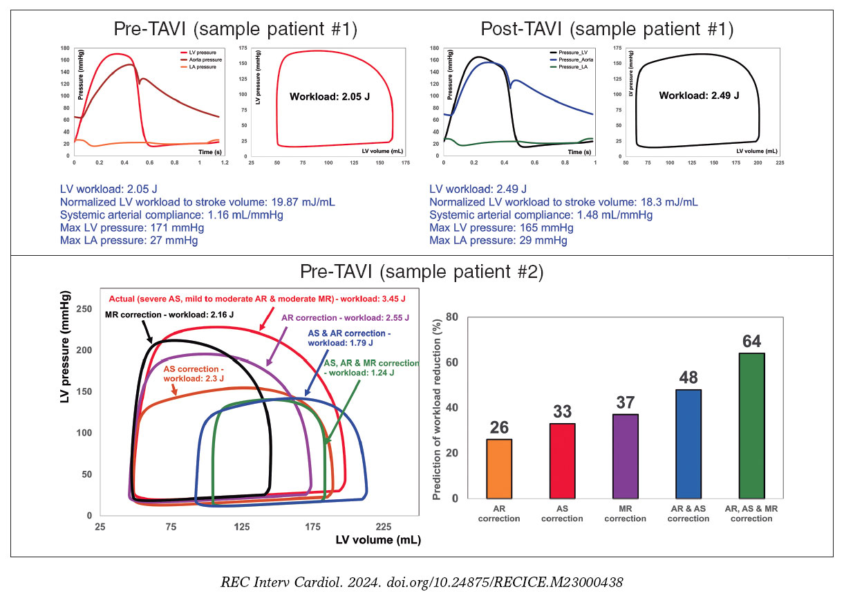 Ventricular pressure-volume loop and other heart function metrics can ...