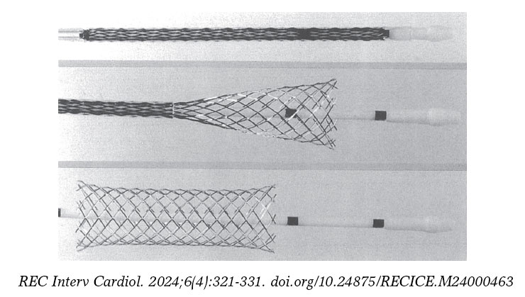 Inception of the coronary stent: a story of successful collaboration ...