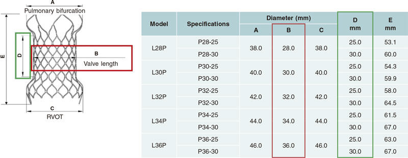 Initial experience with the new percutaneous pulmonary self-expandable ...