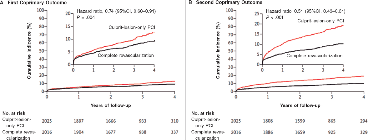COMPLETE revascularization after STEMI? Sure, go ahead