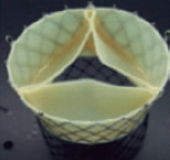 Percutaneous management of tricuspid regurgitation. Image-guided step ...