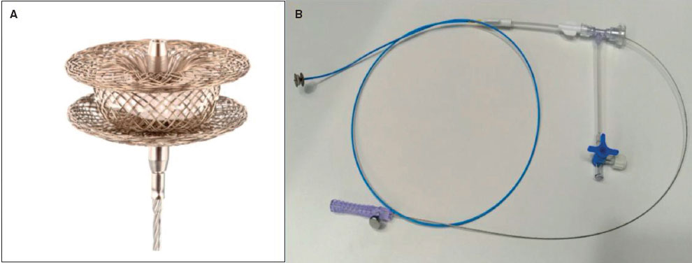 Transcatheter mitral paravalvular leak closure with the KONAR occluder ...